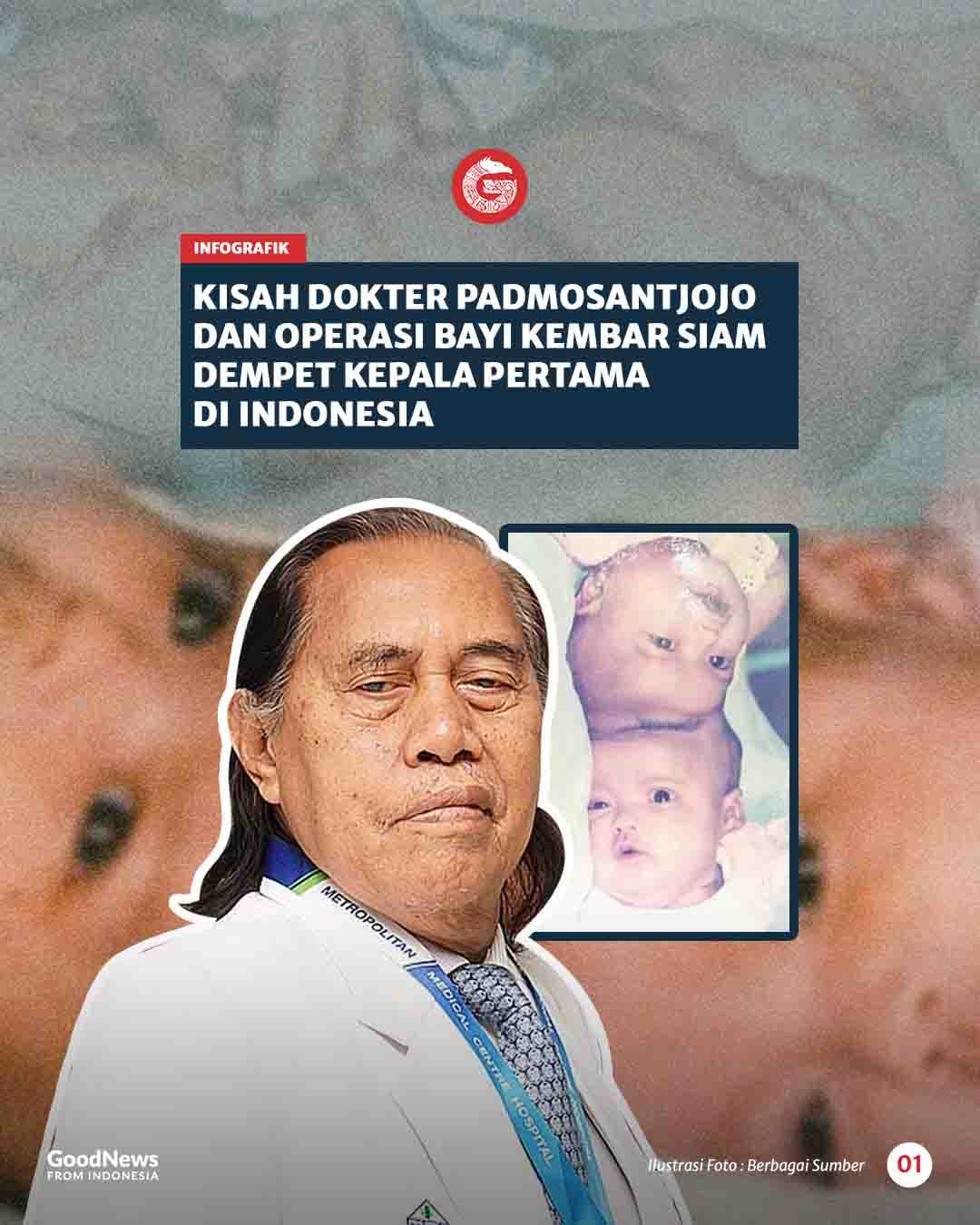 Kisah Dokter Padmosantjojo dan Operasi Bayi Kembar Siam Dempet Kepala ...