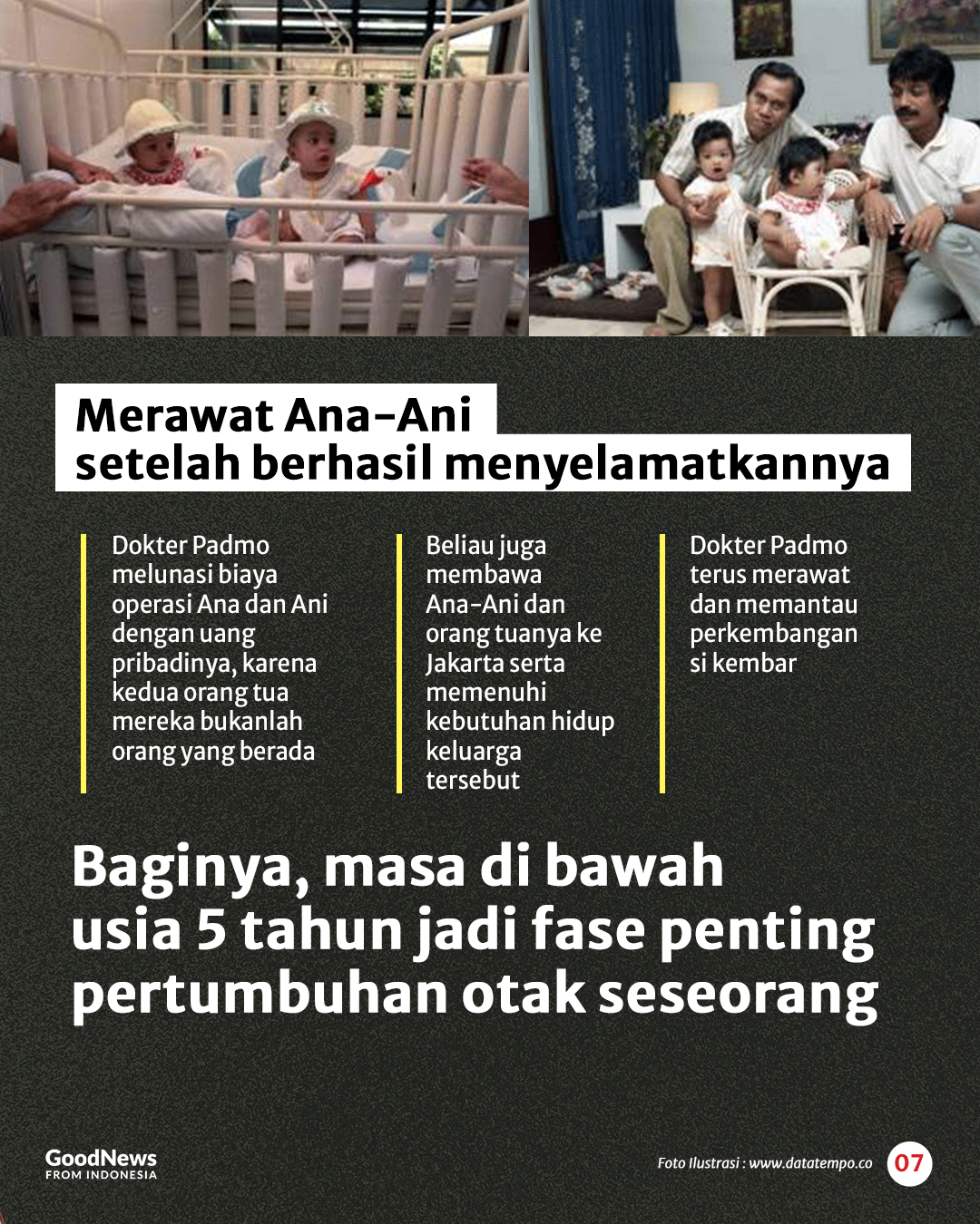 Kisah Dokter Padmosantjojo dan Operasi Bayi Kembar Siam Dempet Kepala ...